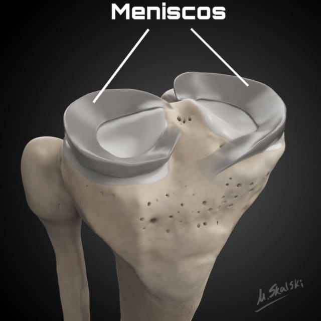 Tratamento e cirurgia do menisco. Leitura importante! - Dr. Fernando Cury